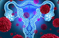 Types of Cervical Cancer | Stages of Cervical Cancer | PatientsEngage