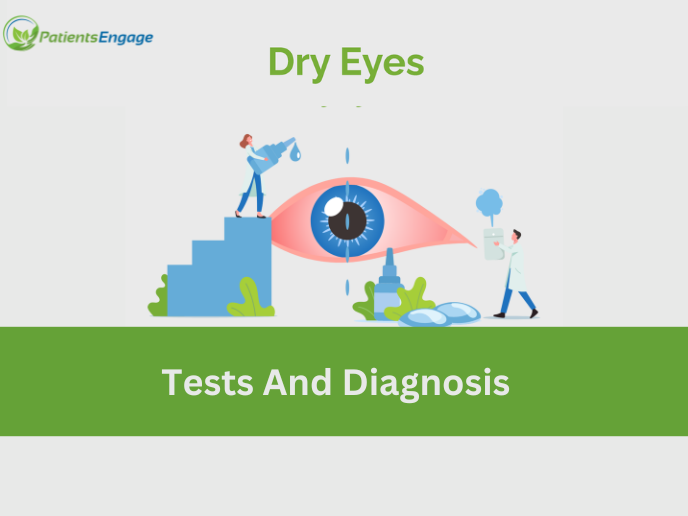Tests and Diagnosis for Dry Eyes | PatientsEngage