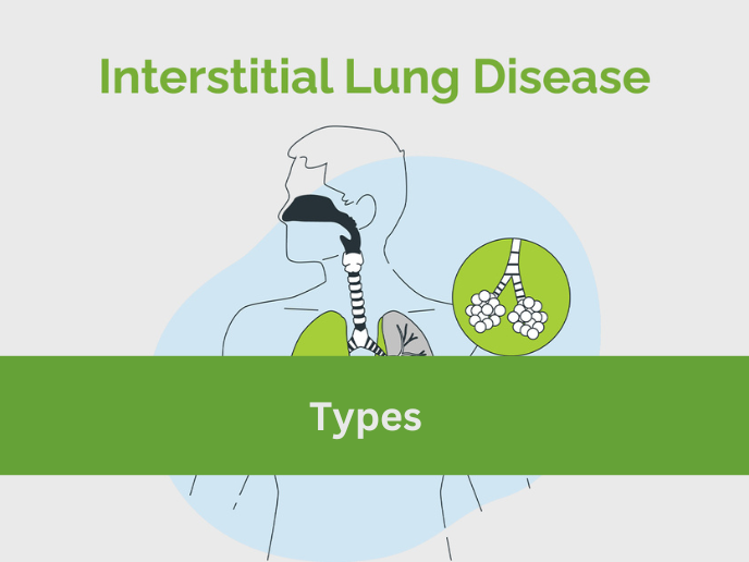 Types of Interstitial Lung Disease | PatientsEngage