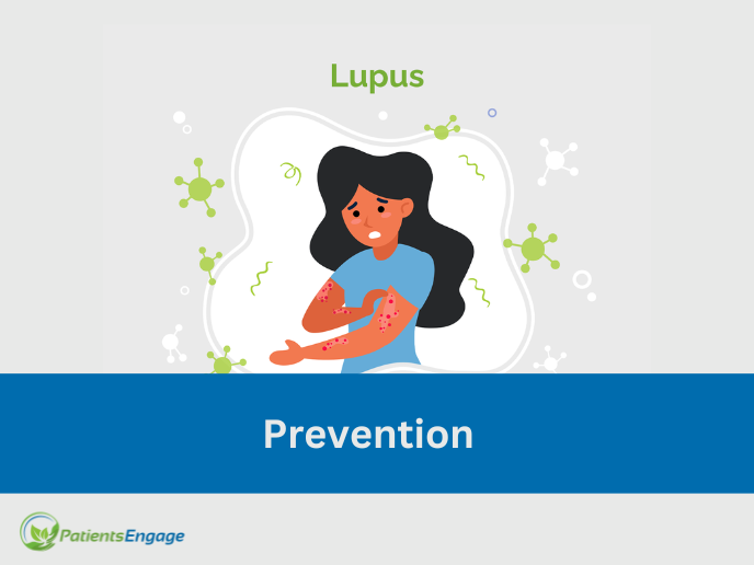 Lupus Prevention | Prevention of Lupus | Prevent Lupus