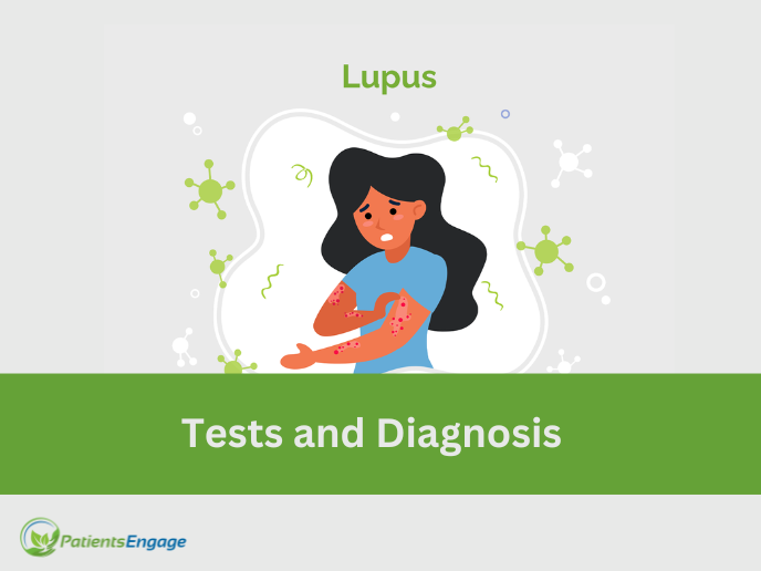 Lupus Tests and Diagnosis | How lupus is diagnosed | Lupus Blood Tests