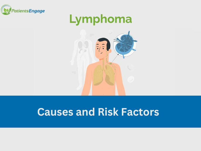 Causes and risk factors of different types of Lymphoma