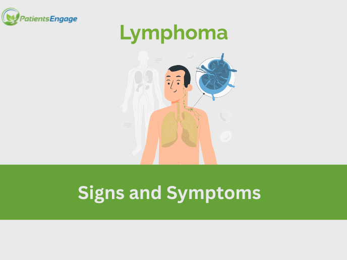 Sign and Symptoms of Lymphoma | What are Lymphoma Symptoms and Signs