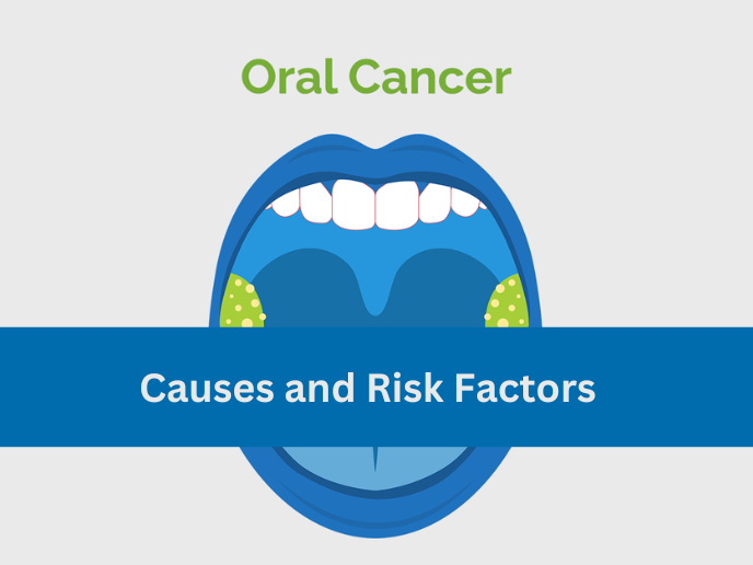 Risk factors for Oral Cancer | What are the Risk Factors for Oral Cancer