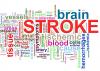 Tests for Stroke | PatientsEngage
