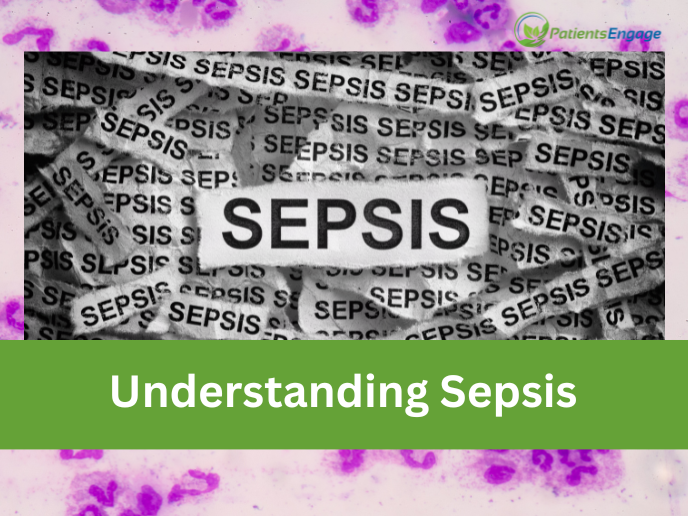 Understanding Sepsis - Frequently Asked Questions | PatientsEngage