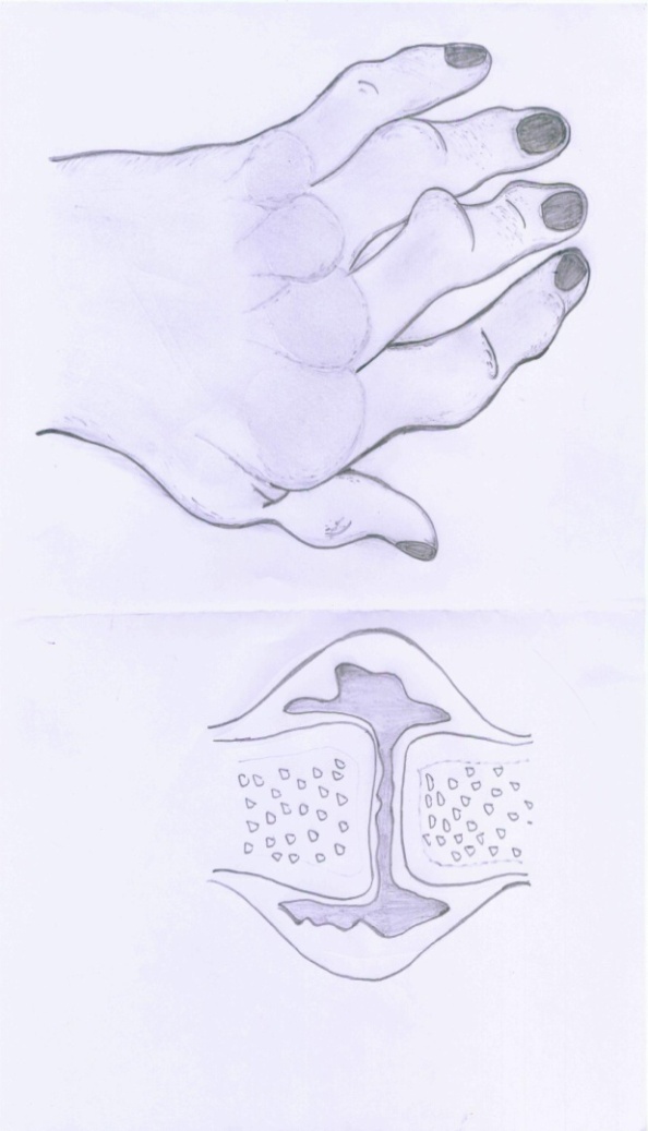 Types of Arthritis | Arthritis Types | Different types of arthritis ...