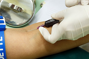 What do the numbers on your blood report mean? | How to read your blood ...